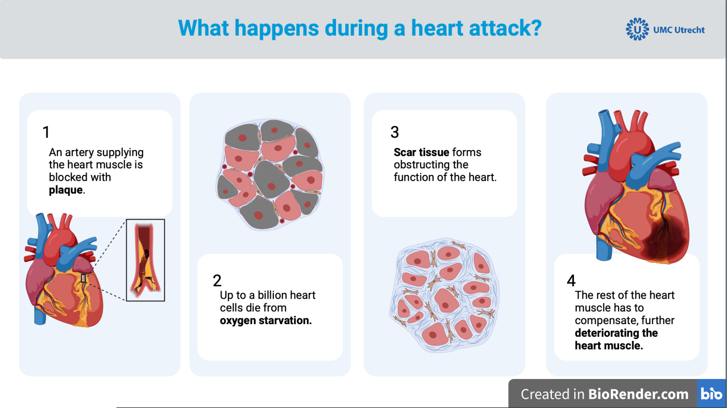 Biofabrication for heart repair - Research at UMC Utrecht