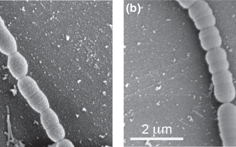 Two previously unknown bacterial species identified from patients with ...